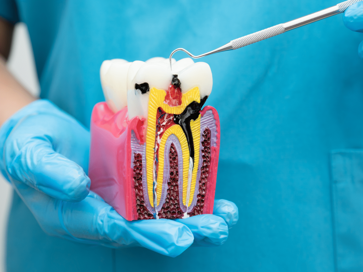7 Common Dental Problems, Oral Diseases, And Tooth Disorders